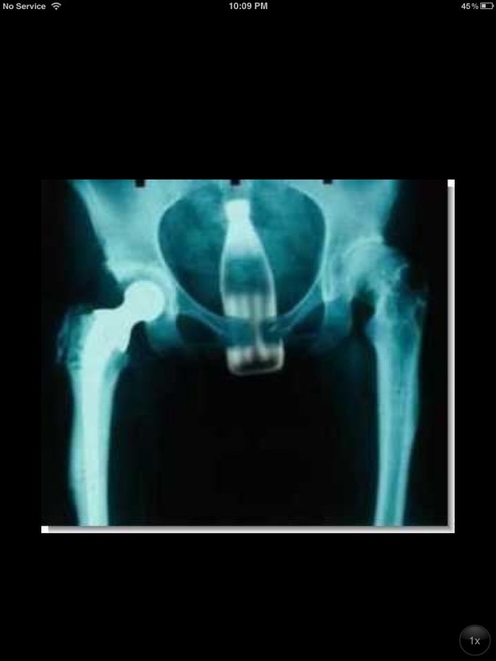 Union Imaging Center, 445 Chestnut St, Union Twp, NJ - MapQuest