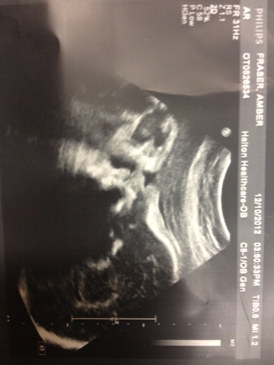 Oakville-Trafalgar Memorial Hospital, 327 Reynolds St, Oakville, ON ...